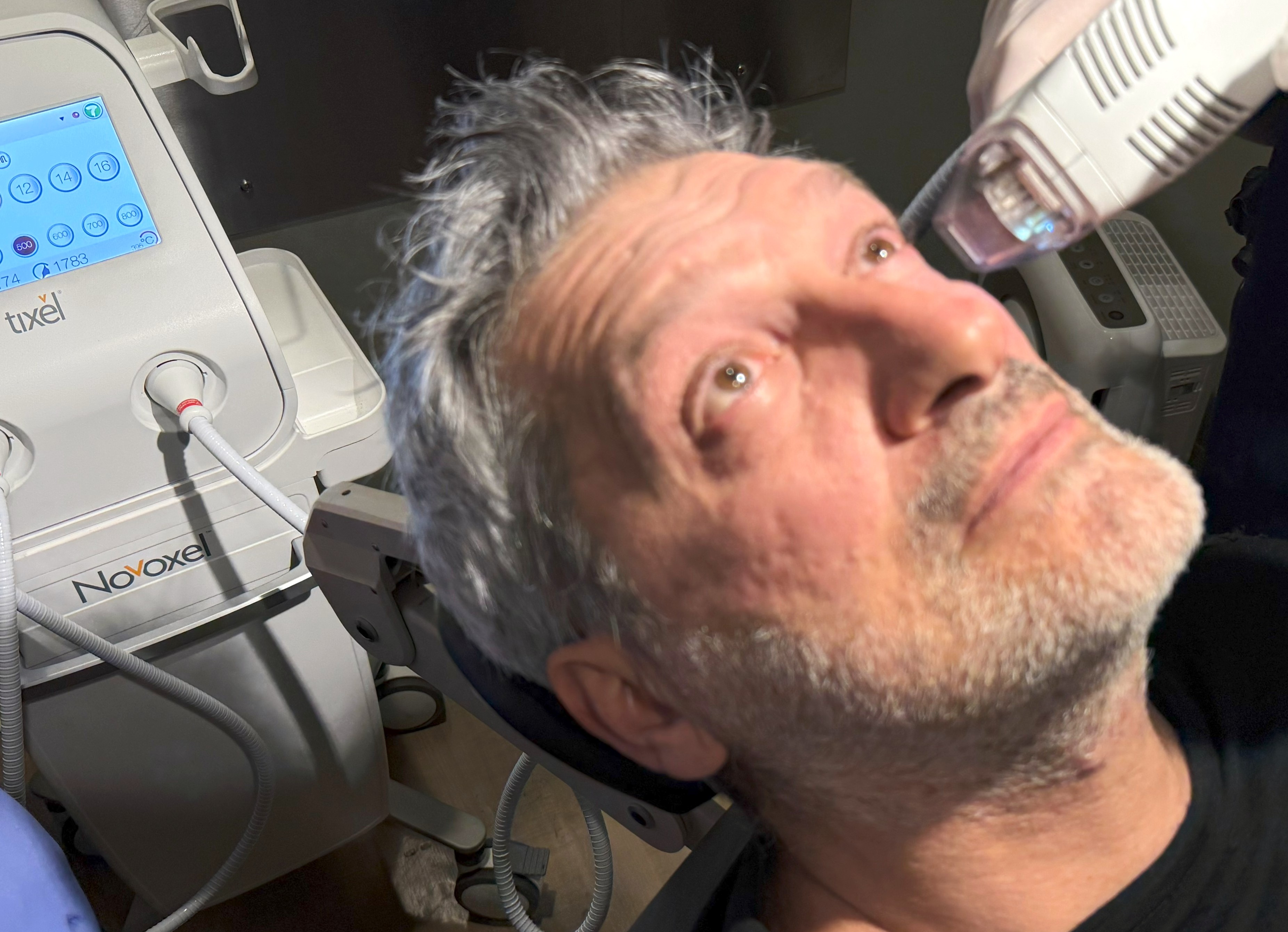 Combining Multiple Treatment Modalities: A Holistic Approach to Dry Eye ...